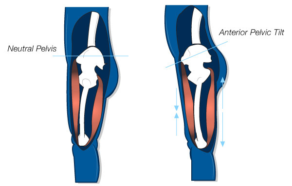 A Real Pain In The Butt: How To Treat 'Sit Bone' Pain | Ascent Chiropractic