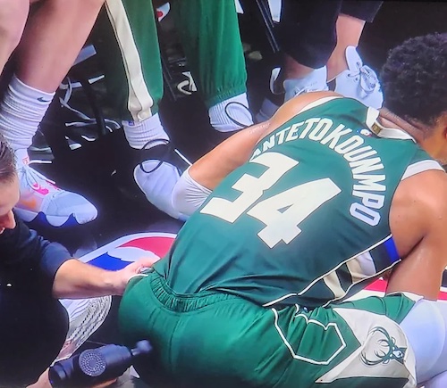 Giannis' Low Back Injury: What's a Back Contusion & How Long Does It ...